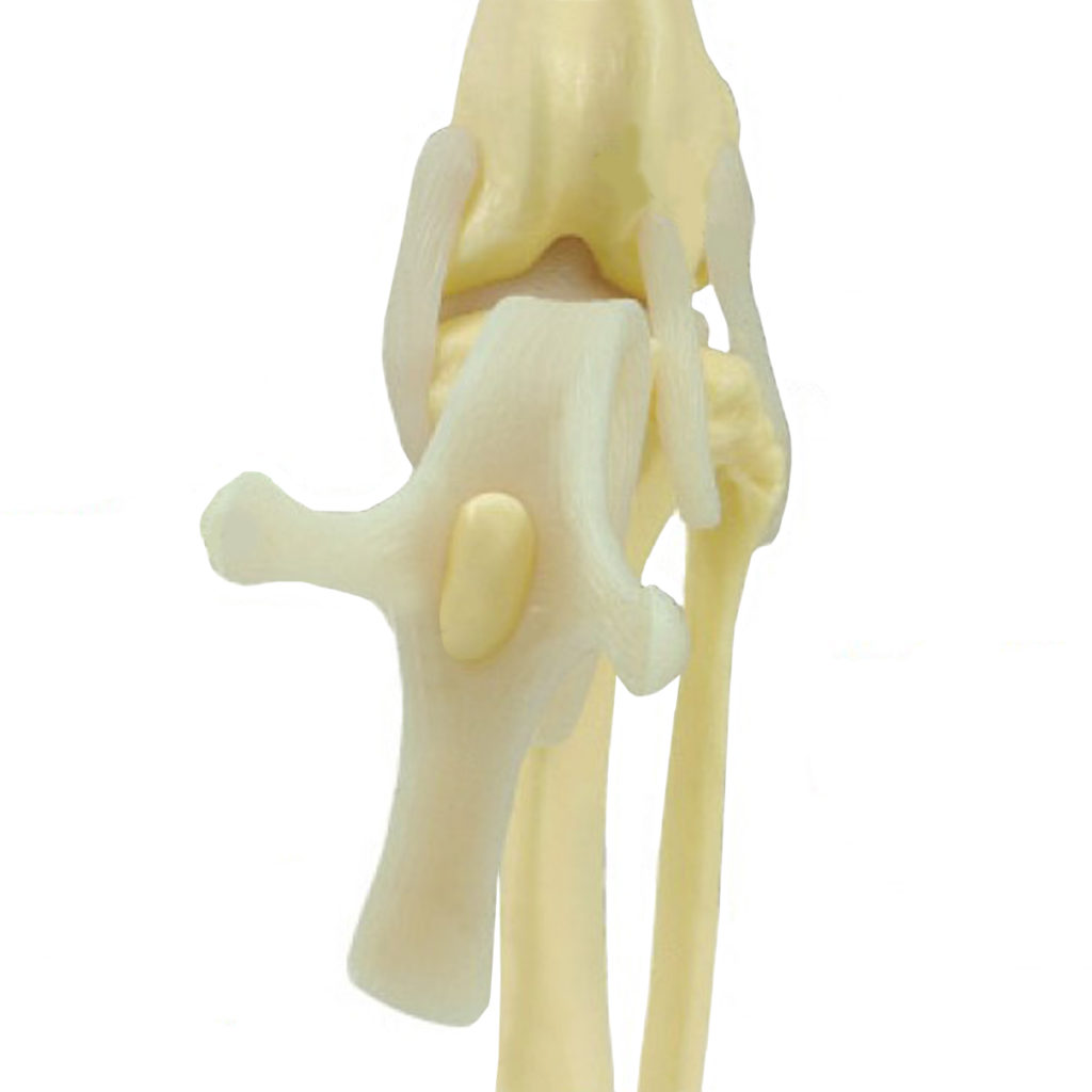 Arquivos menisco lateral | MogiGlass Anatomia e Simulação