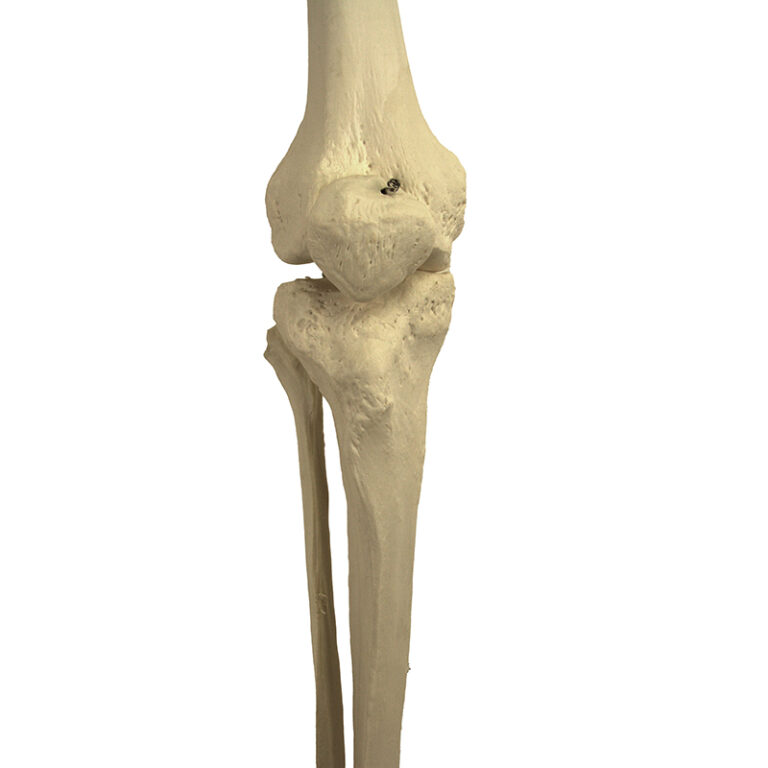 Esqueleto da Perna | MogiGlass Anatomia e Simulação