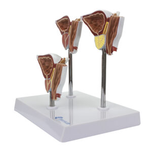 Série da Próstata Normal e Patologia | MogiGlass Anatomia e Simulação